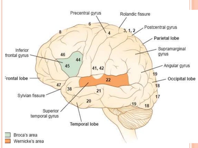 Aphasia and types | PPTX | Brain and Nervous System Disorders ...