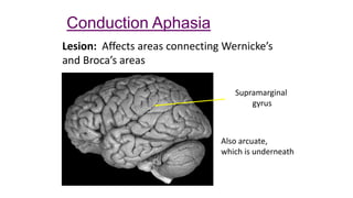 Aphasias & Apraxias.pptx