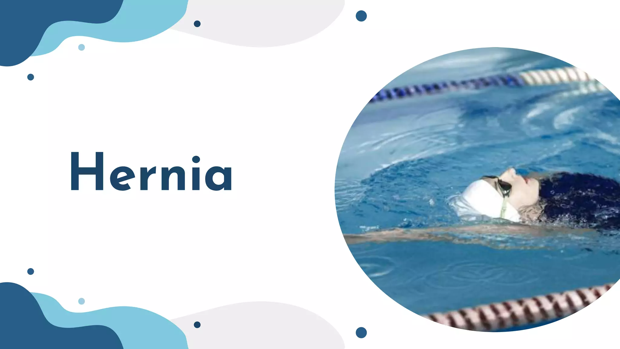 Appendicitis and Hernia.pptx