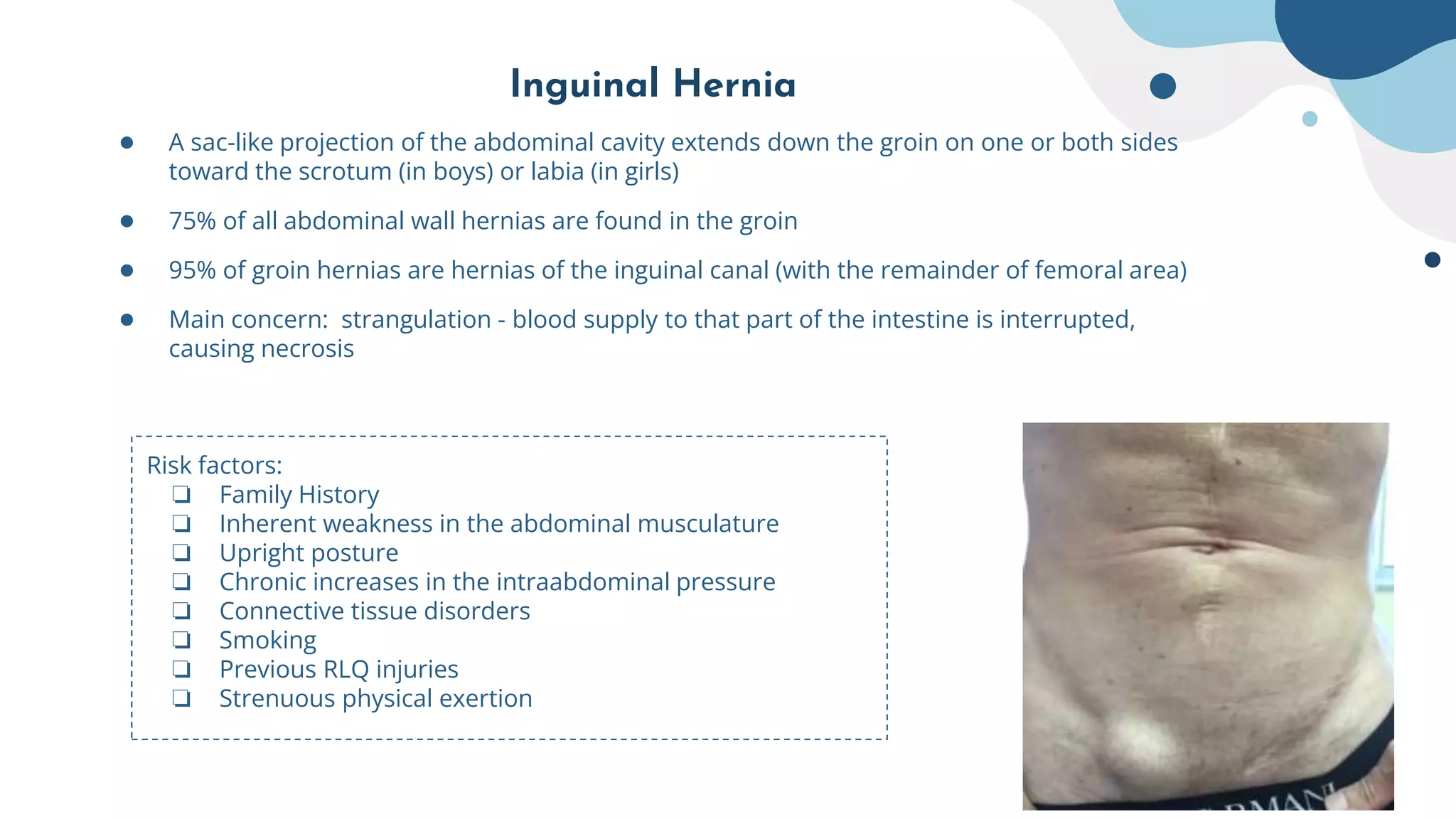 Appendicitis and Hernia.pptx