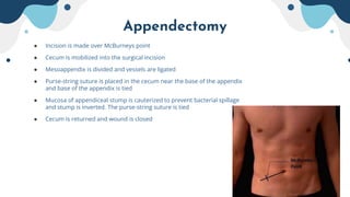 Appendicitis and Hernia.pptx