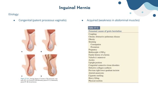 Appendicitis and Hernia.pptx