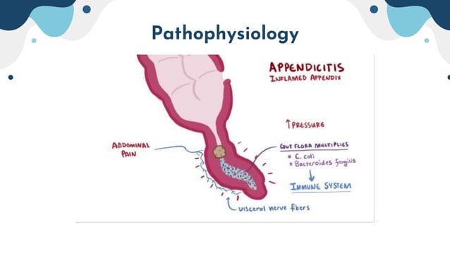 Appendicitis and Hernia.pptx
