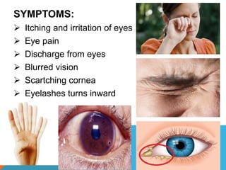 TETANUS AND TRACHOMA | PPTX
