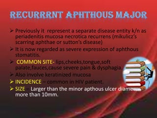 Aphthous Ulcer | PPTX