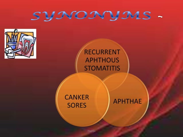 Aphthous Ulcer | PPTX