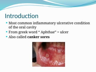 Aphthous ulcer-oral medicine and radiology.pptx