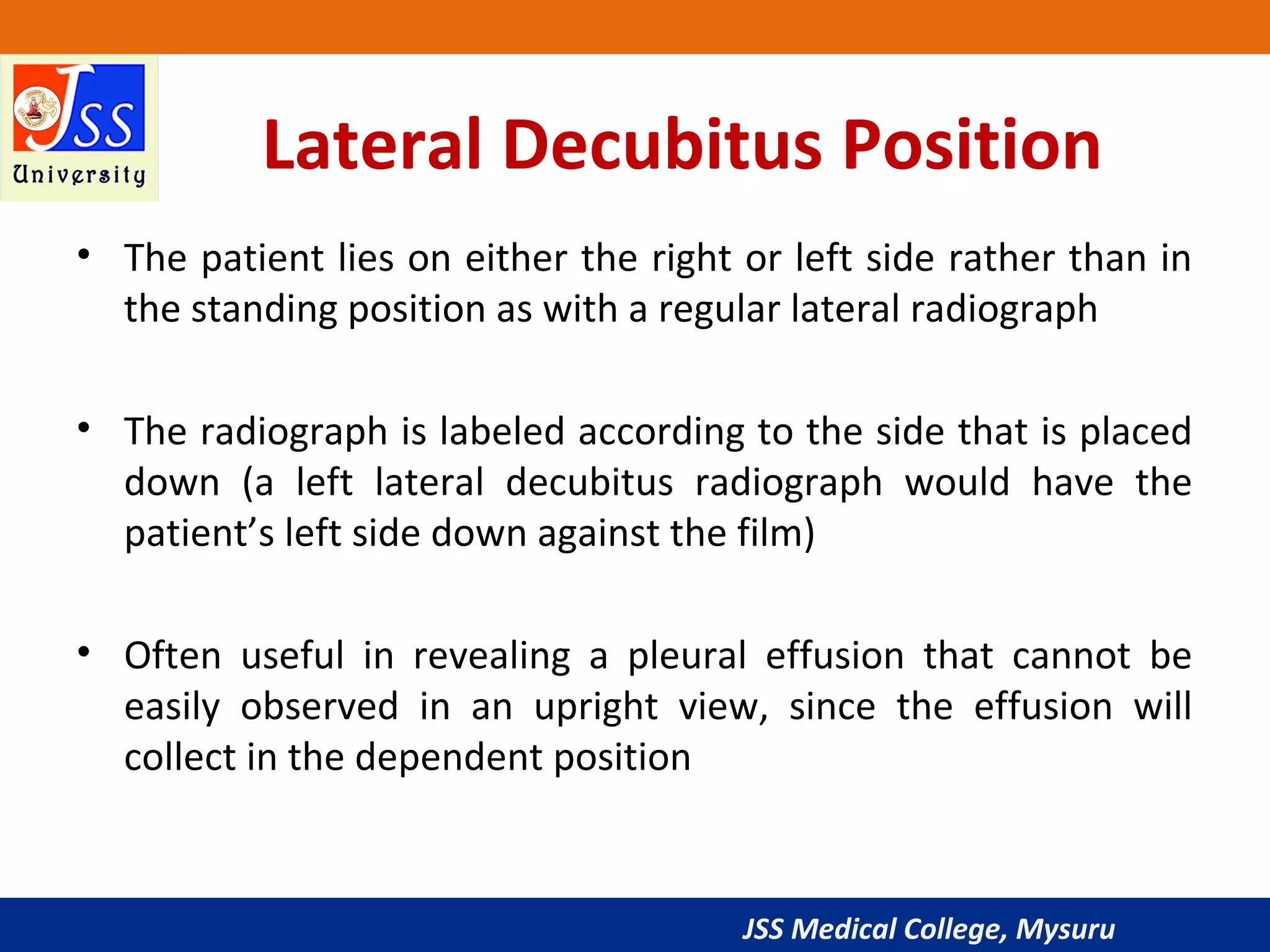 Approach to Chest X-Ray and Interpretation | PPT