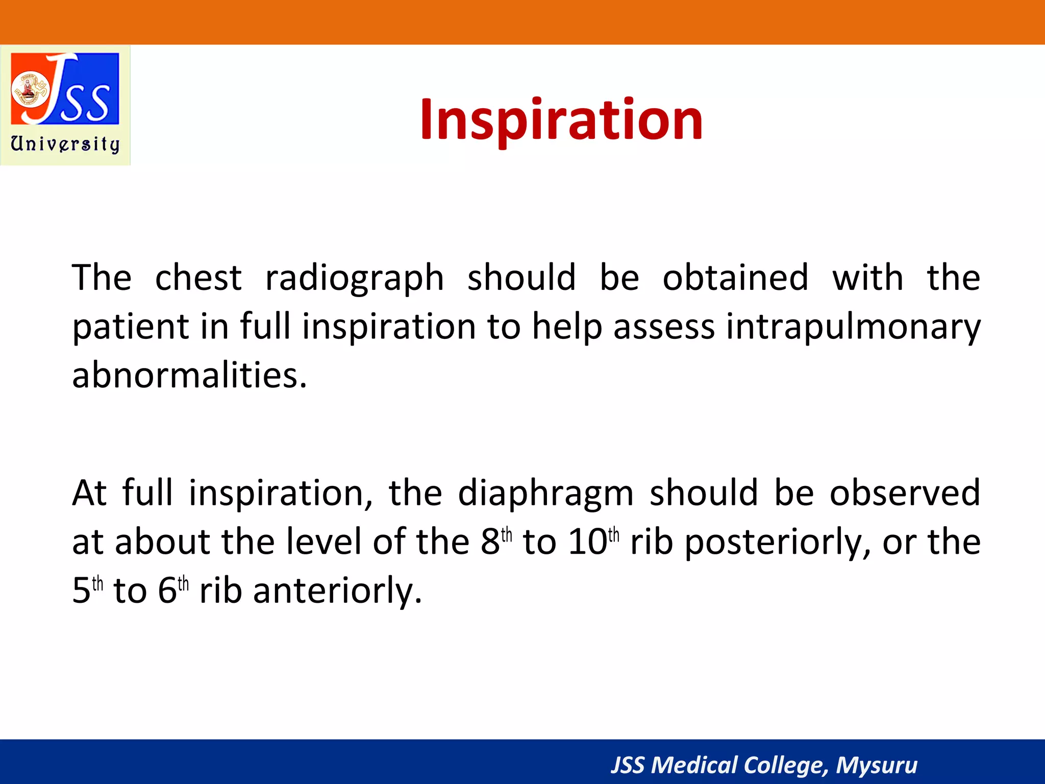 Approach to Chest X-Ray and Interpretation | PPT