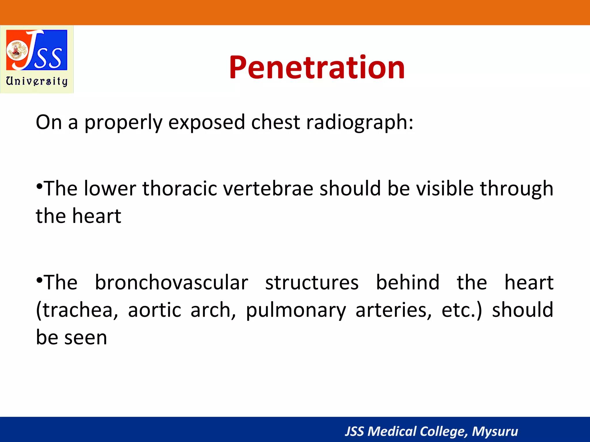 Approach to Chest X-Ray and Interpretation | PPT