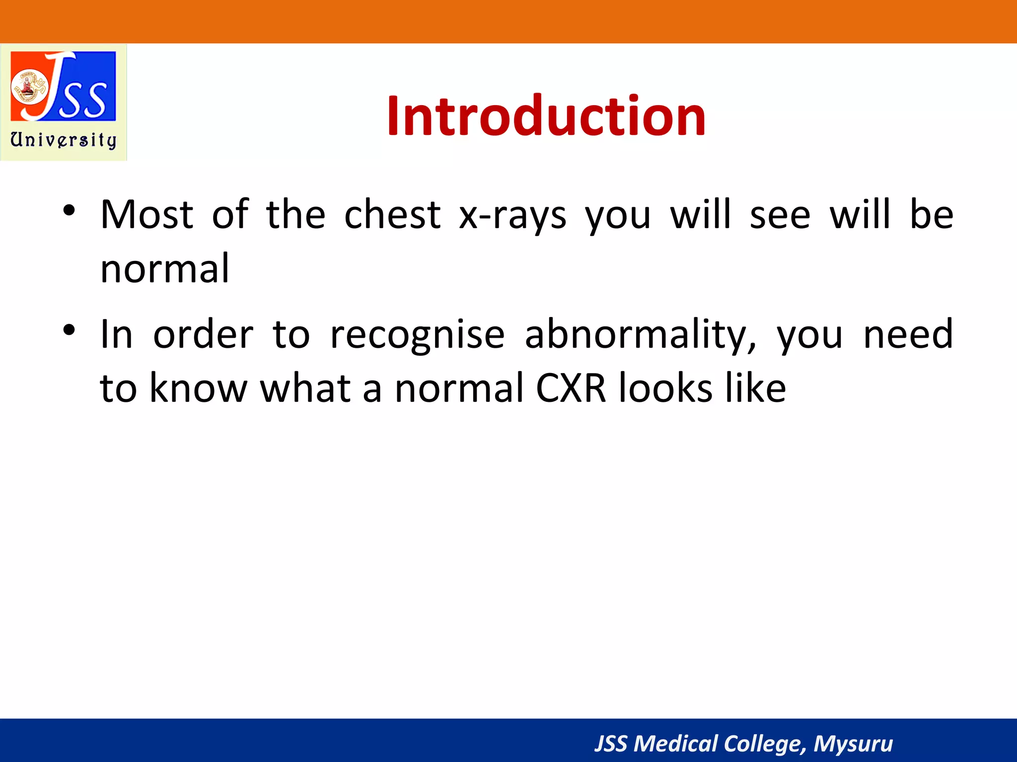 Approach to Chest X-Ray and Interpretation | PPT