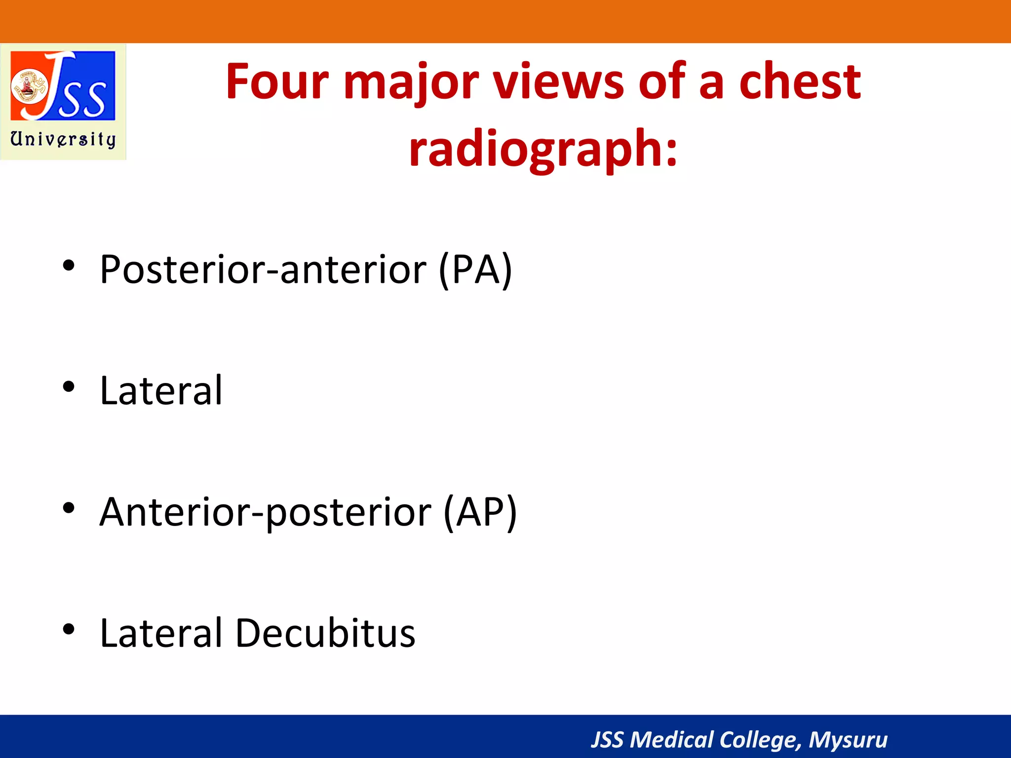 Approach to Chest X-Ray and Interpretation | PPT