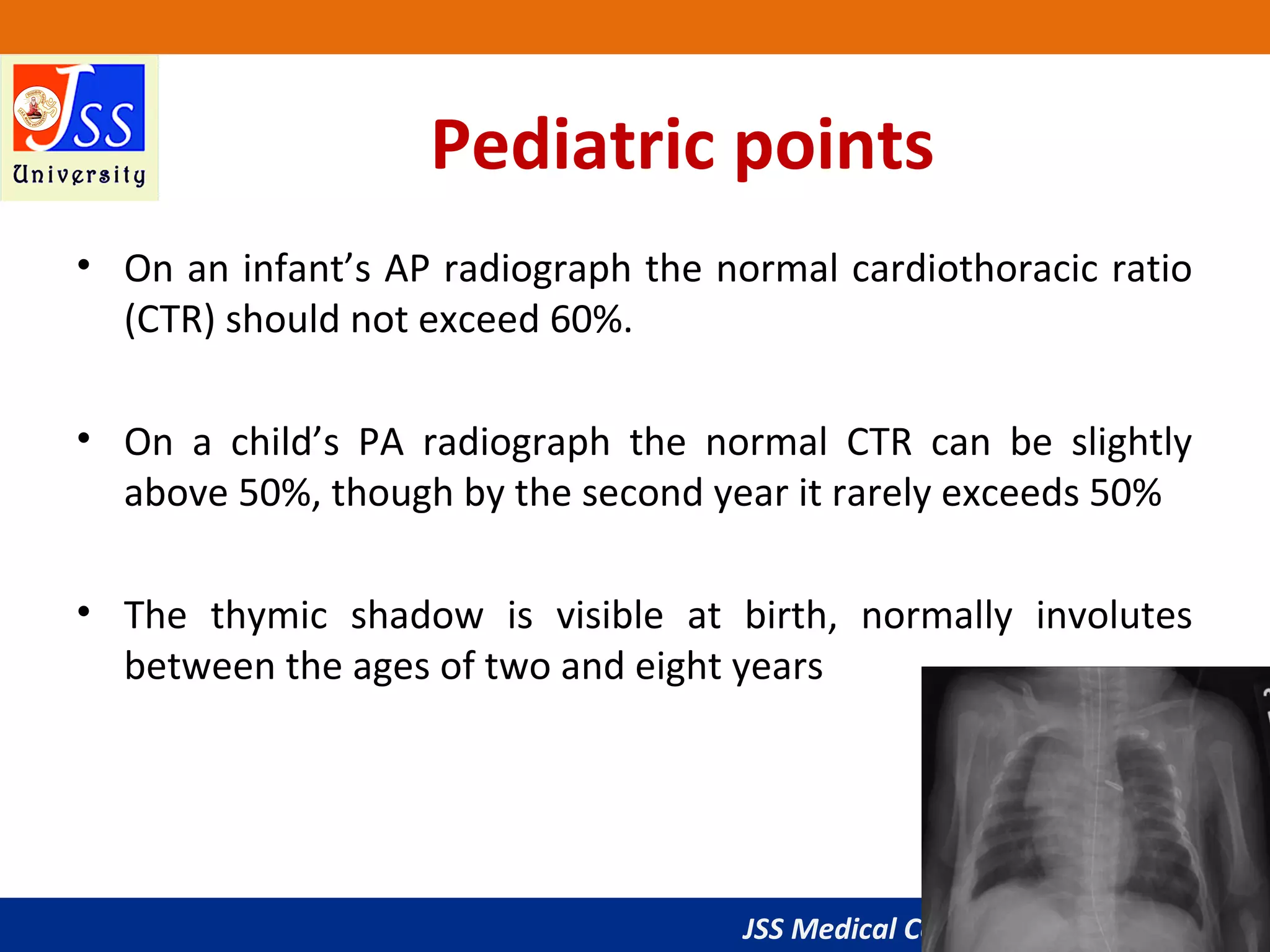 Approach to Chest X-Ray and Interpretation | PPT