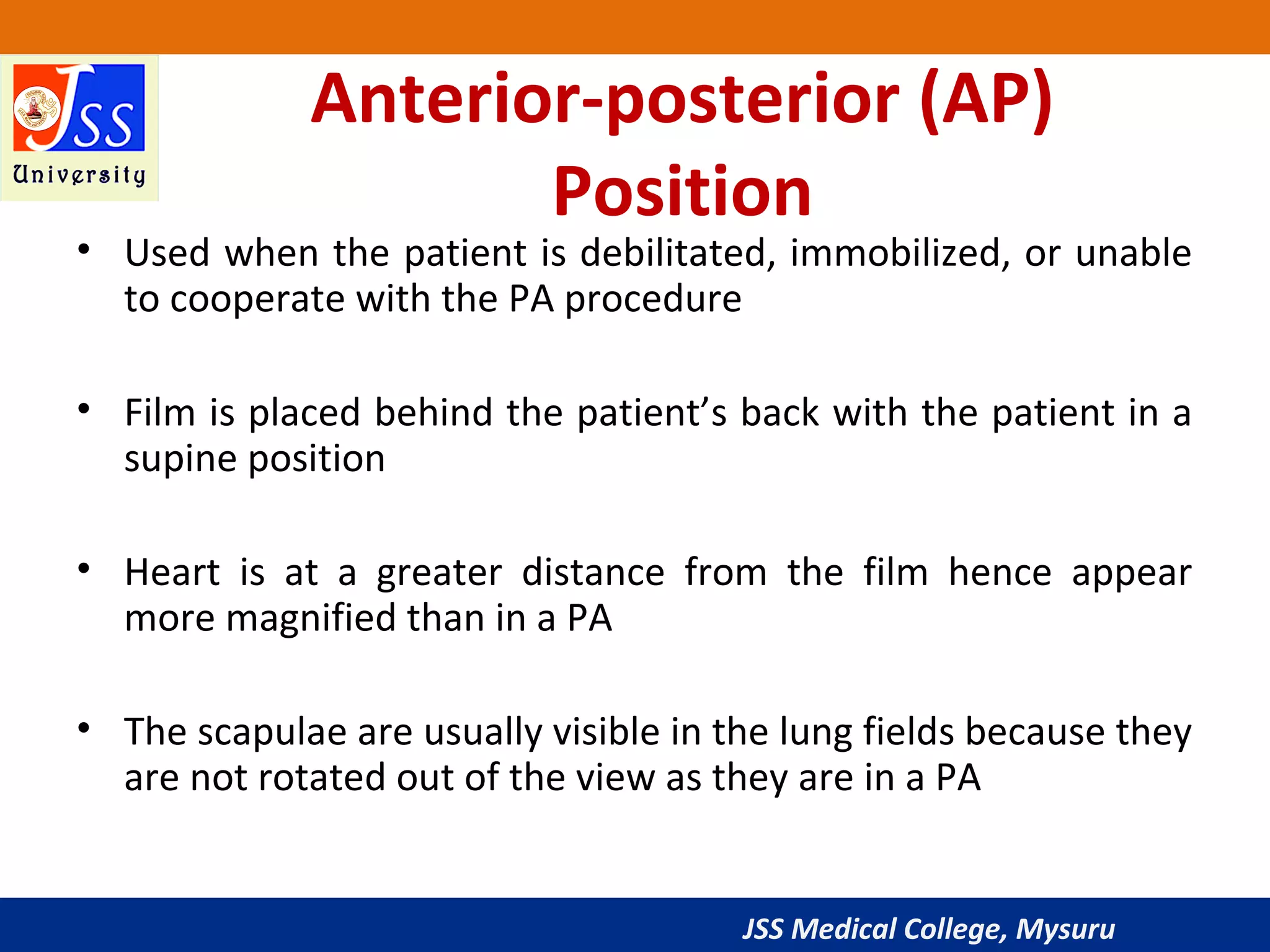 Approach to Chest X-Ray and Interpretation | PPT