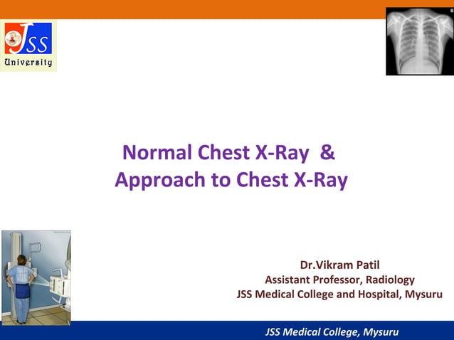 Approach to Chest X-Ray and Interpretation | PPT