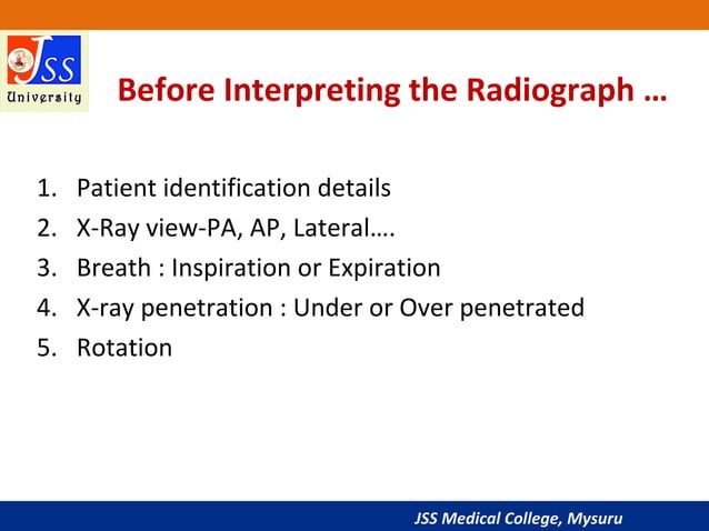Approach to Chest X-Ray and Interpretation | PPT