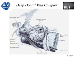 Apical dissection athens 2011 | PPTX