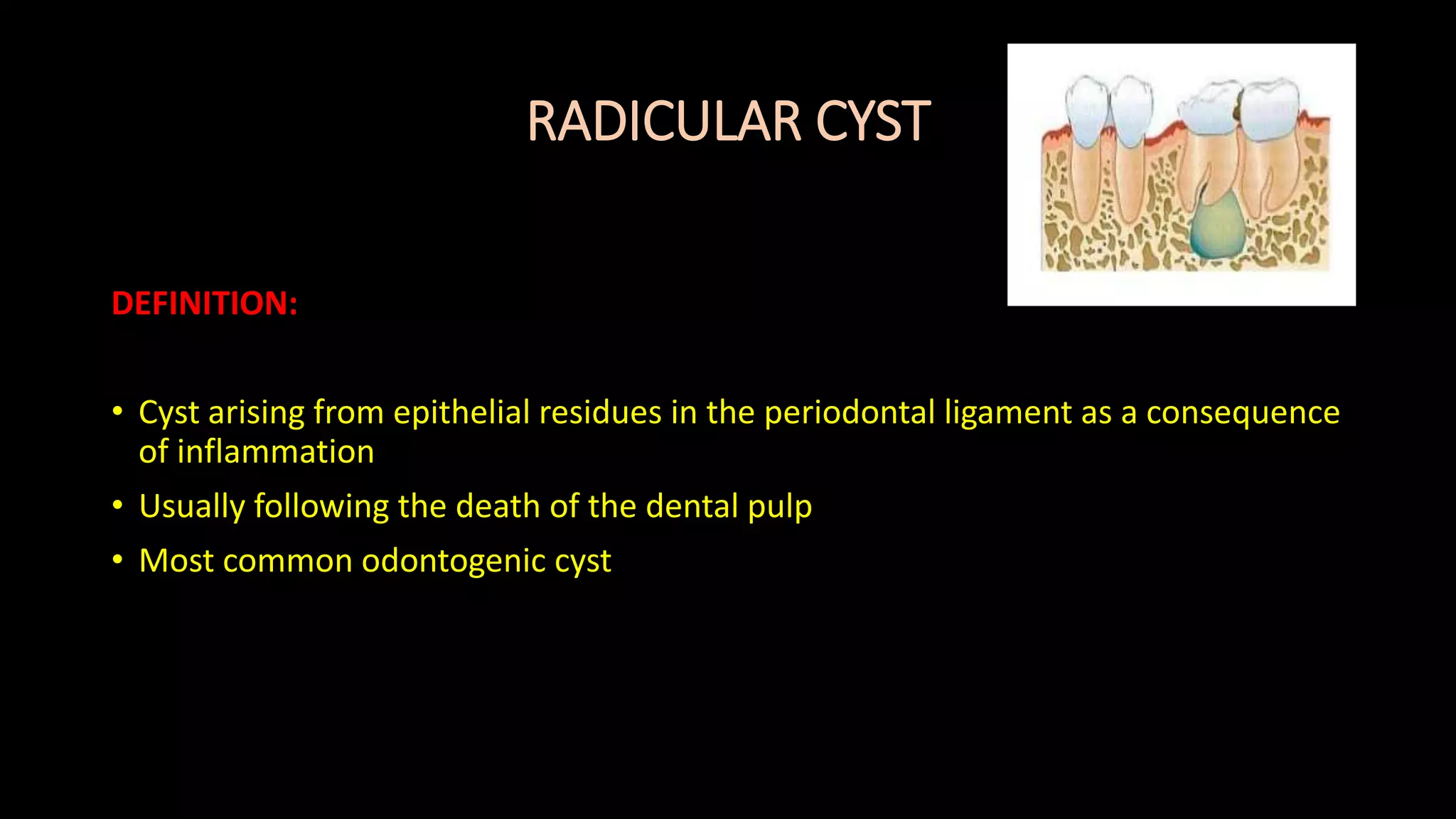 Apical lesions in dentistry | PPTX