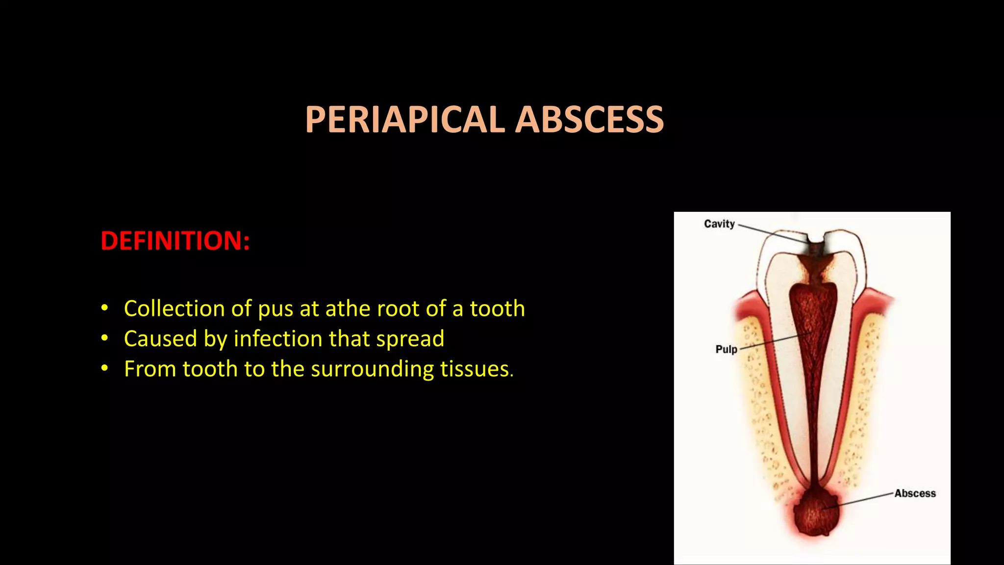 Apical lesions in dentistry | PPTX