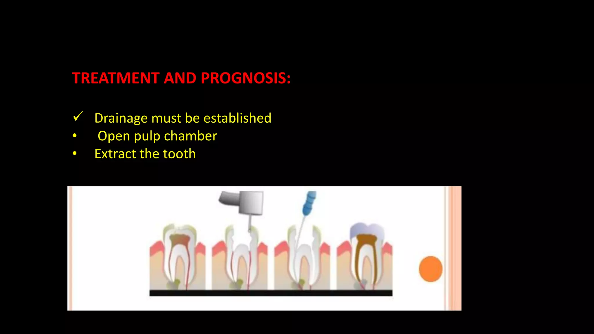 Apical lesions in dentistry | PPTX