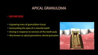 Apical lesions in dentistry | PPTX | Dental Health | Diseases and ...