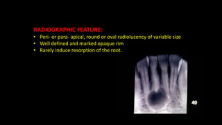 Apical lesions in dentistry | PPTX | Dental Health | Diseases and ...