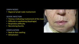 Apical lesions in dentistry | PPTX