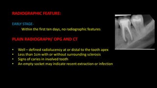 Apical lesions in dentistry | PPTX | Dental Health | Diseases and ...