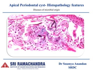 Apical peridontal cyst, Periapical abscess.pptx