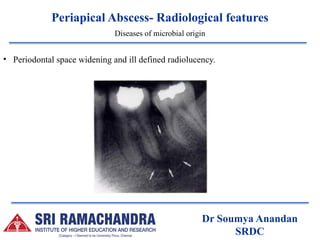 Apical peridontal cyst, Periapical abscess.pptx