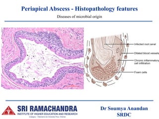 Apical peridontal cyst, Periapical abscess.pptx