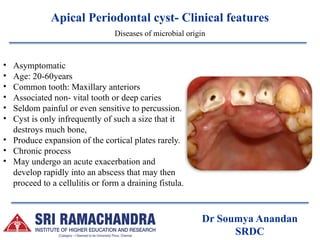 Apical peridontal cyst, Periapical abscess.pptx