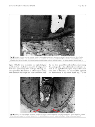 Apical termination of root canal | PDF