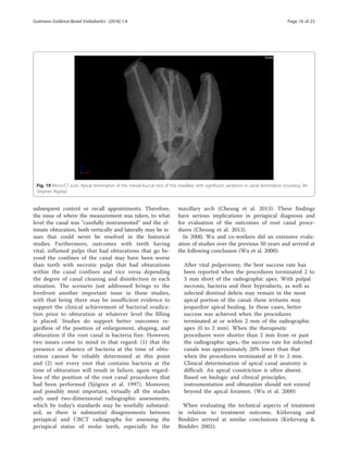 Apical termination of root canal | PDF