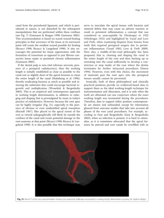 Apical termination of root canal | PDF