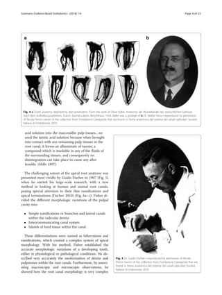 Apical termination of root canal | PDF | Dental Health | Diseases and ...