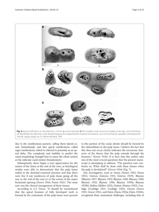 Apical termination of root canal | PDF | Dental Health | Diseases and ...