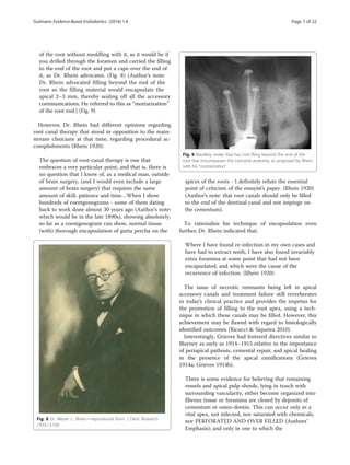 Apical termination of root canal | PDF | Dental Health | Diseases and ...