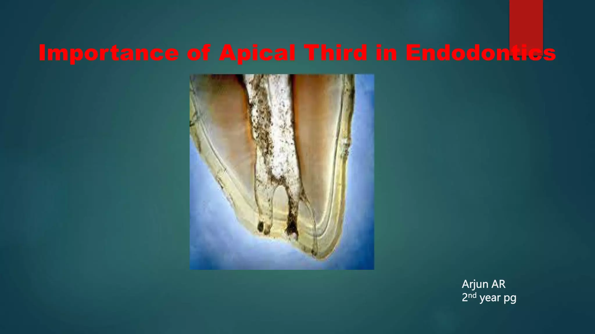 APICAL THIRD PPT.pptx