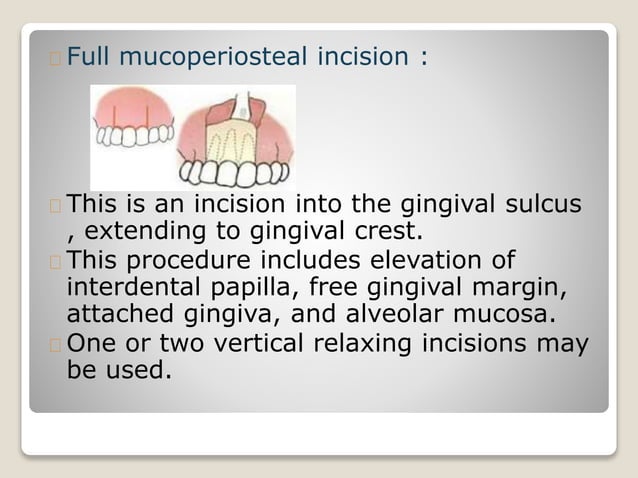Apicoectomy | PPTX