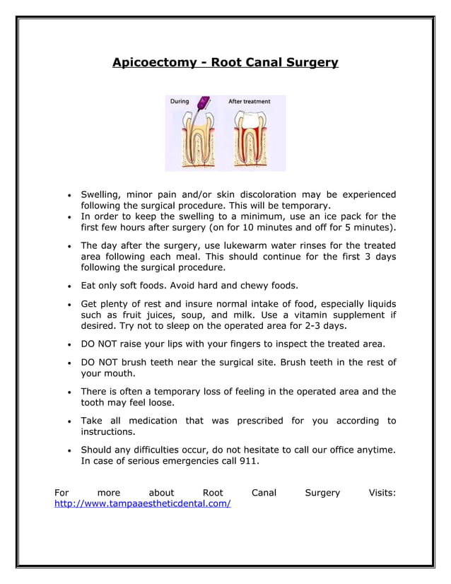 Apicoectomy root canal surgery | DOC