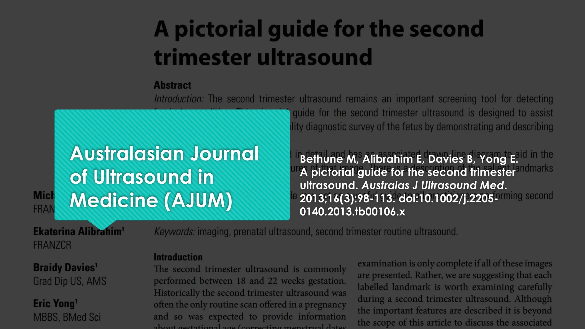 A pictorial guide for the 2nd Trimester USG | PPTX