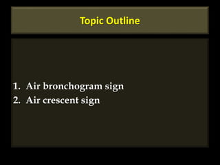 A pictorial review of “signs in thoracic imaging 01” | PPT