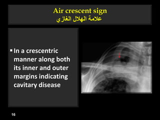 Air Crescent Sign