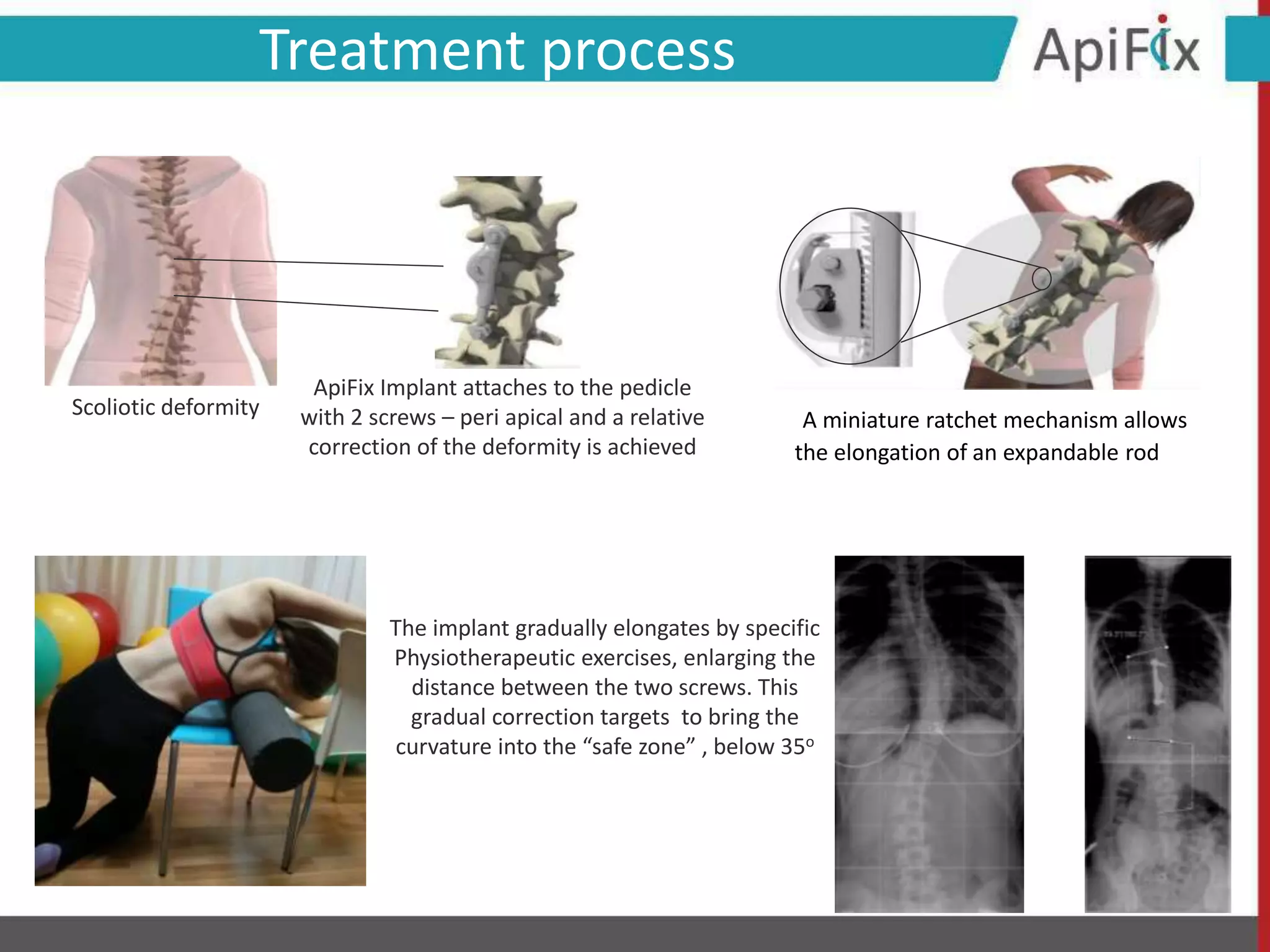 Apifix presentation english version | PPTX