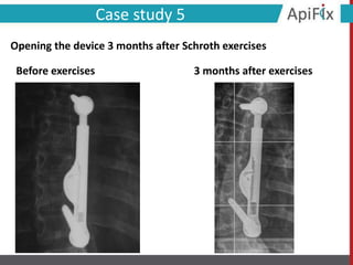 Apifix presentation english version | PPT