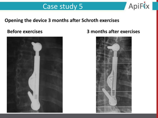 Apifix presentation english version | PPTX