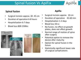 Apifix presentation english version | PPT