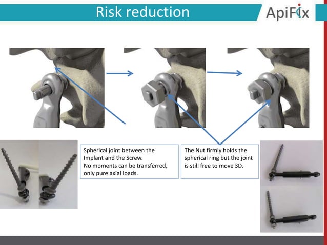 Apifix presentation english version | PPTX