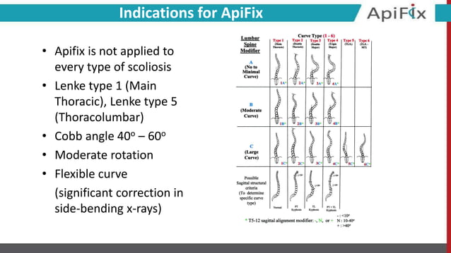 ApiFix treatment for Adolescent Idiopathic Scoliosis (AIS): The ...
